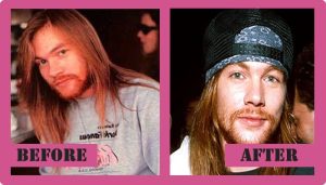 Axl-Rose-Plastic-Surgery-Before-And-After | CelebReligions.com