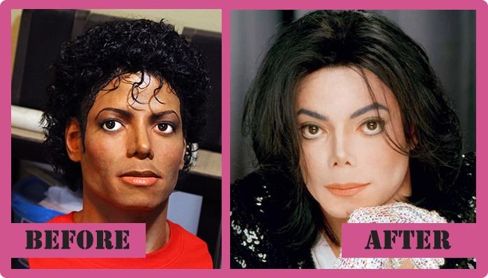 Michael-Jackson-Plastic-Surgery-Before-And-After | CelebReligions.com