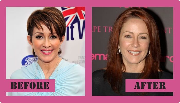 Patricia-Heaton-Plastic-Surgery-Before-And-After | CelebReligions.com